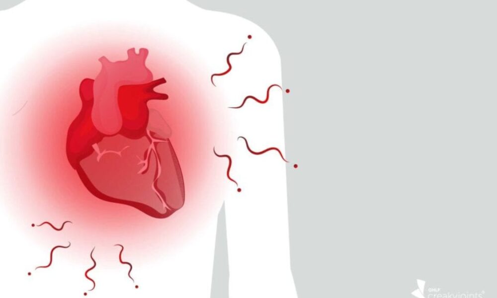 Balancing Joint and Heart Health: Navigating the Intersection of ...