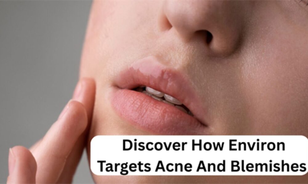 Discover How Environ Targets Acne And Blemishes